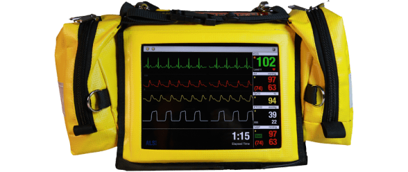 Paediatric Resuscitation Basics – EmergencyPedia