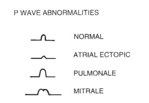 12 Lead ECG – EmergencyPedia