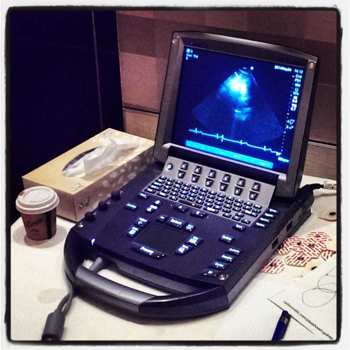 Echocardiography Basics – EmergencyPedia