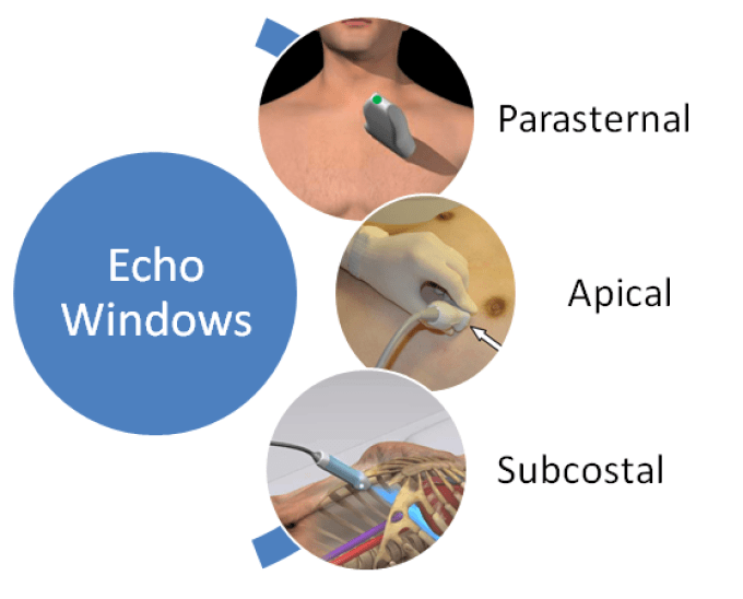 Echocardiography Basics – EmergencyPedia