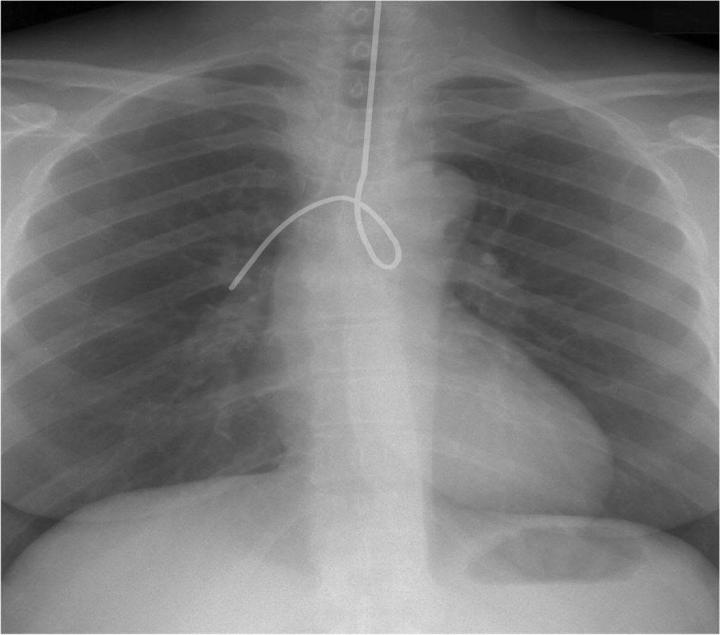 6 Clinical Radiology Practice Cases – EmergencyPedia