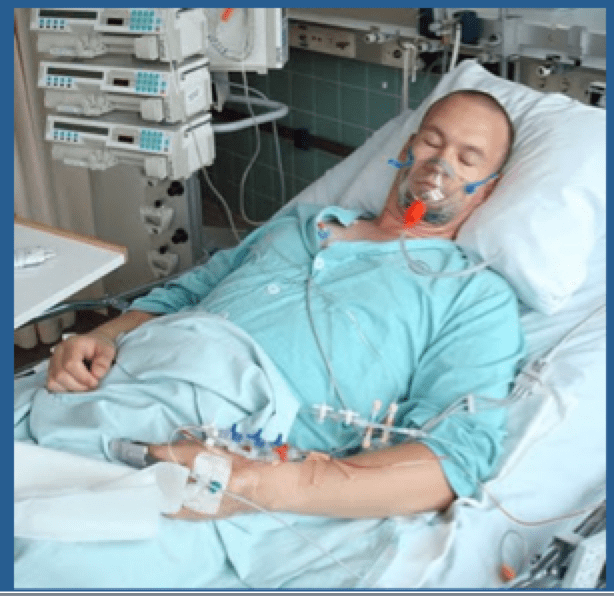 Acute Respiratory Distress Syndrome (ARDS) – EmergencyPedia
