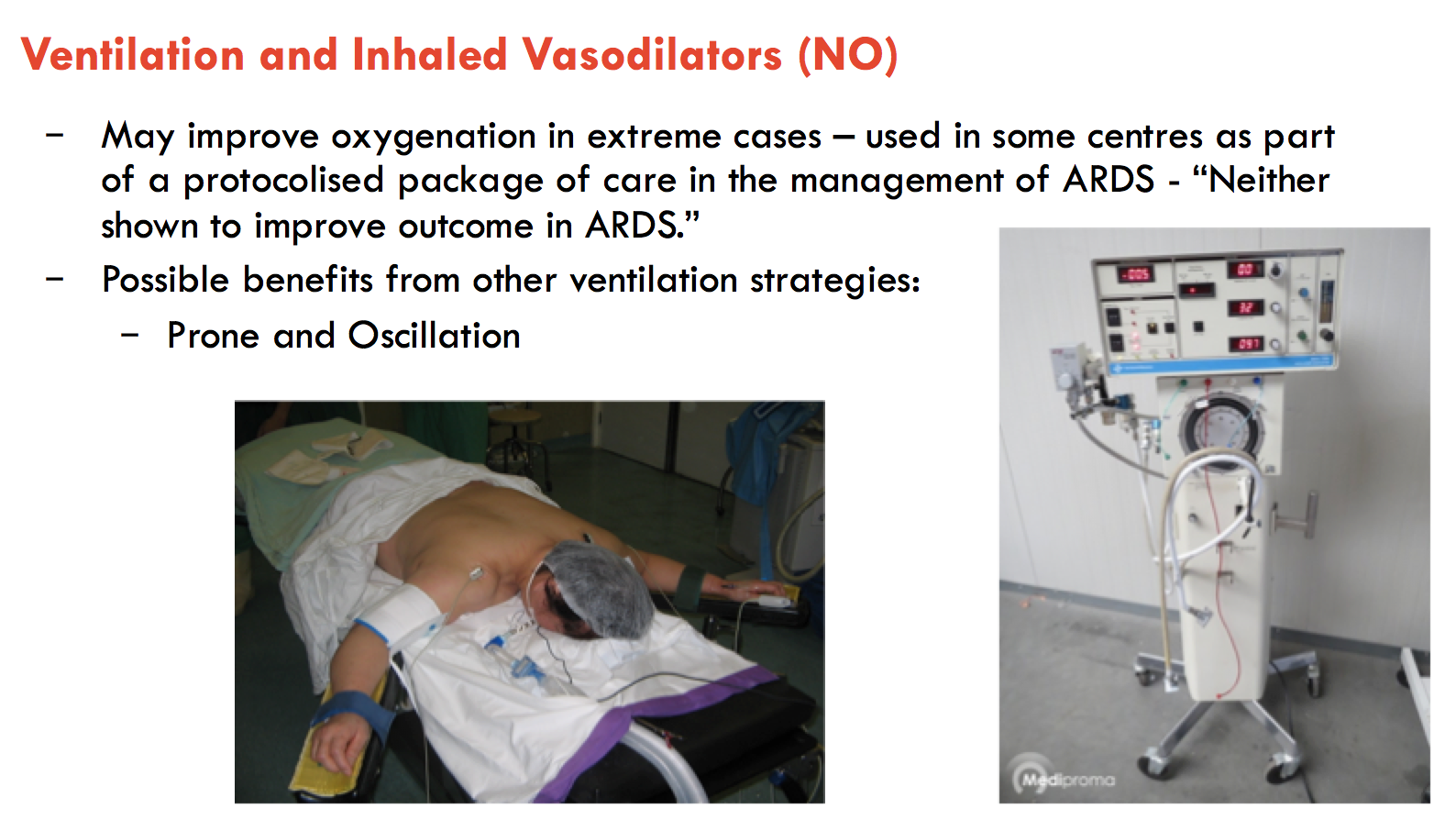 Acute Respiratory Distress Syndrome (ARDS) – EmergencyPedia