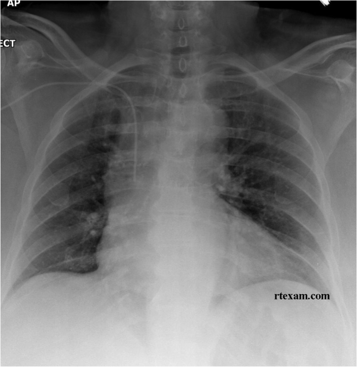 6 Clinical Radiology Practice Cases – EmergencyPedia