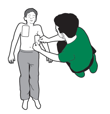 Paediatric Resuscitation Basics – EmergencyPedia